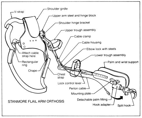 Fig 12A-15. The Stanmore flail arm orthosis us | O&P Digital Resource Library