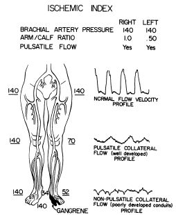 Collateral Circulation Lower Extremity
