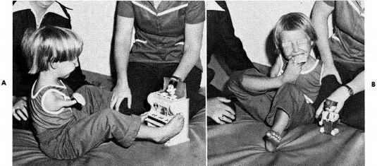 Fig 36A-2. Training in use of the foot should | O&P Digital Resource ...